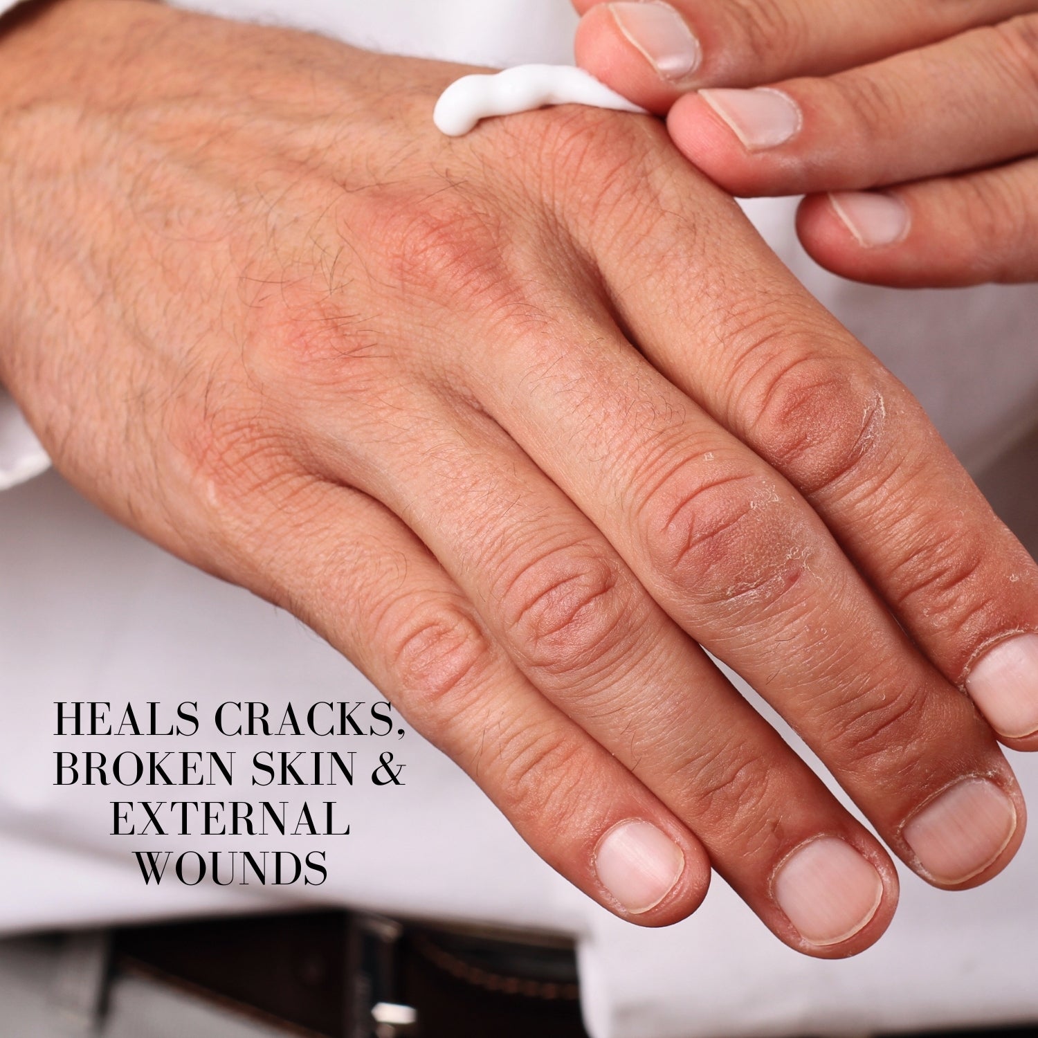 SALCOLL COLLAGEN Hand Cream, Moisturizer, Protection, Healing,150 ml ...